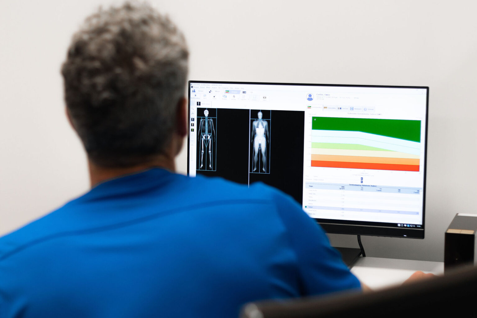 DEXA Scan: Nauwkeurige meting van je lichaamssamenstelling